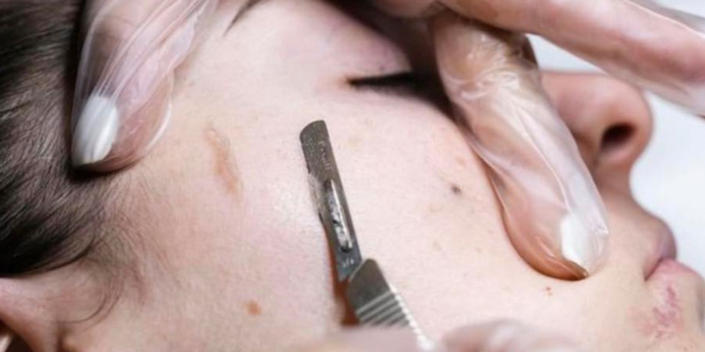 Epi Dermal Blading + High Frequency + Sheet Mask - Beautyologist